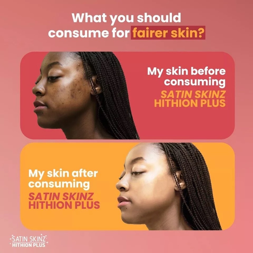 15's Satin Skinz Hithion Plus for African Skin Whitening Brightening ...