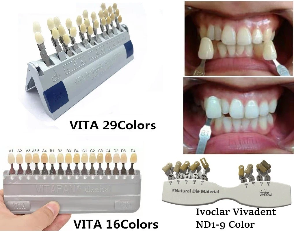 Tooth Color Scale