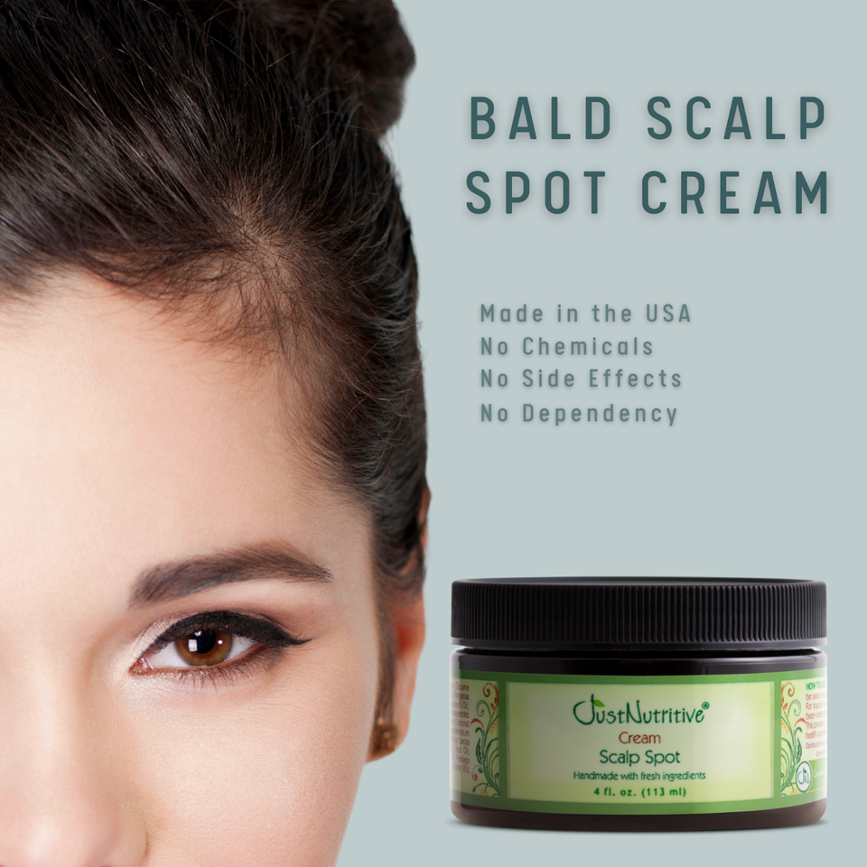 Bald Scalp Spot Cream / Bald Spot Treatment | eBay