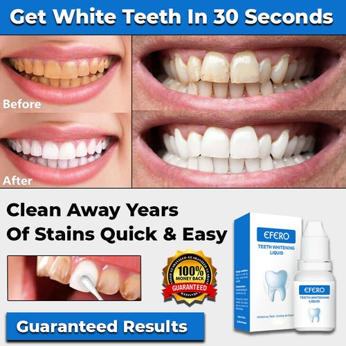 NEW INSTANT TOOTH WHITENING KIT WHITE TEETH CLEAN GEL UV BLEACH DENTAL ...