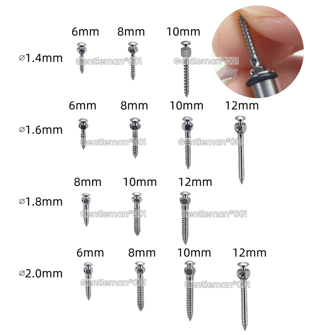 Dental Orthodontic Implant Mini Screw Titanium Micro Bone Screws ...