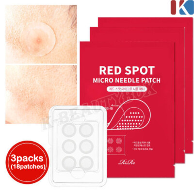 RIRE Red Spot Micro Needle 18 patches Anti Trouble Patch Acne Blemish ...