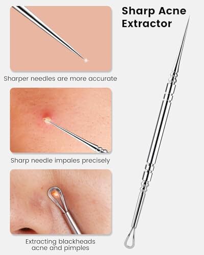 Pimple Popper Tool Kit - 6 Pcs Pore Prep Blackhead Remover Comedone ...
