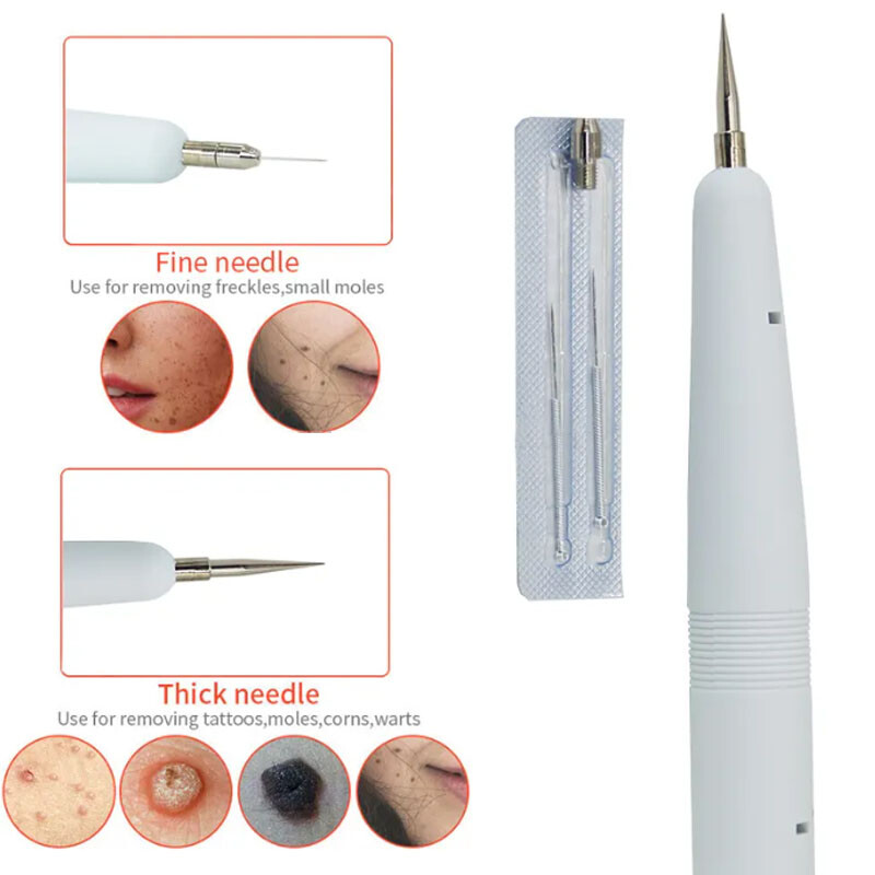 Warts Removal Skin Tag Remover Beauty Instrument Skin Tag Removal ...