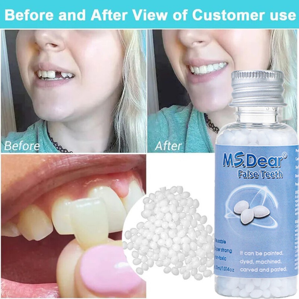 Strong Teeth Tooth Repair Temporary Dental Cement Cavity Filling Kit ...