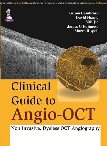 Bruno Lumbroso Yali Jia David Huang Clinical Guide to Angio-OCT: Non In ...