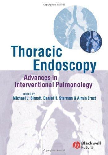 Thoracic Endoscopy : Advances in Interventional Pulmonology by Daniel H ...