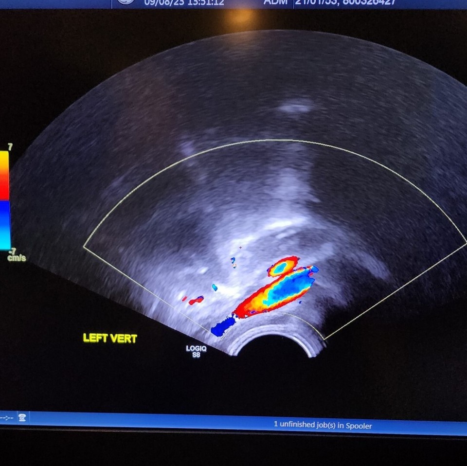 Ge ultrasound probe BE9CS-D | eBay