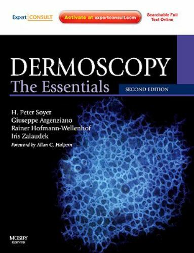 Dermoscopy : The Essentials: Expert Consult - Online and Print by ...
