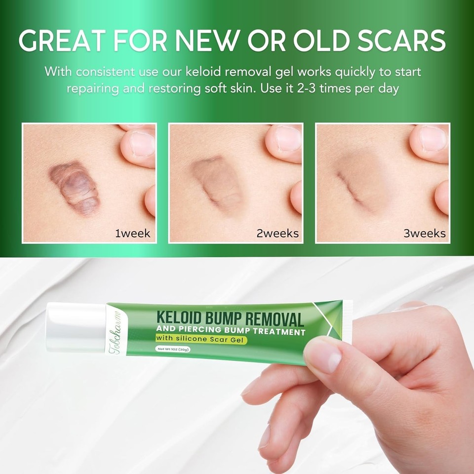 Advanced Keloid Bump Removal Gel: Silicone Keloid Scar Removal Cream ...