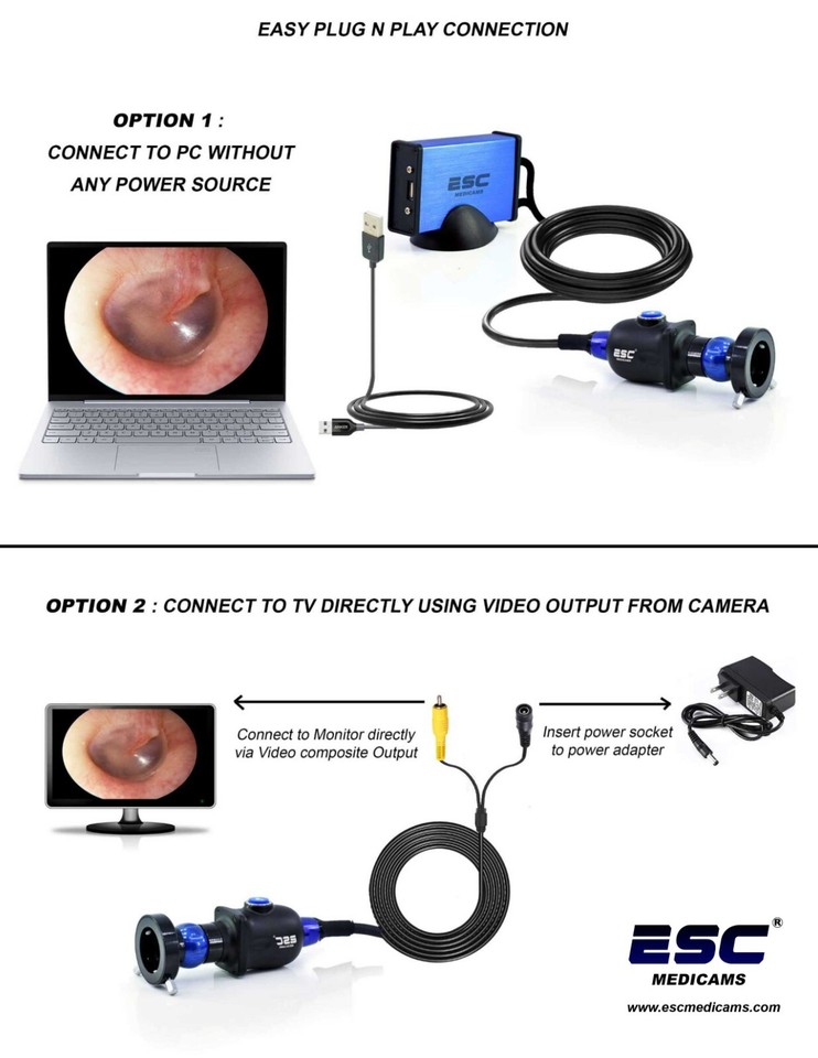 Endoscopy camera HD Portable USB Rigid Endoscope Storz ENT Medical 1 ...