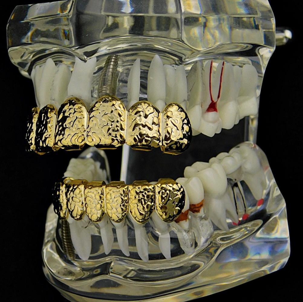 14k Gold Plated "Gold Nugget" Grillz Set Top & Bottom Teeth Hip Hop ...