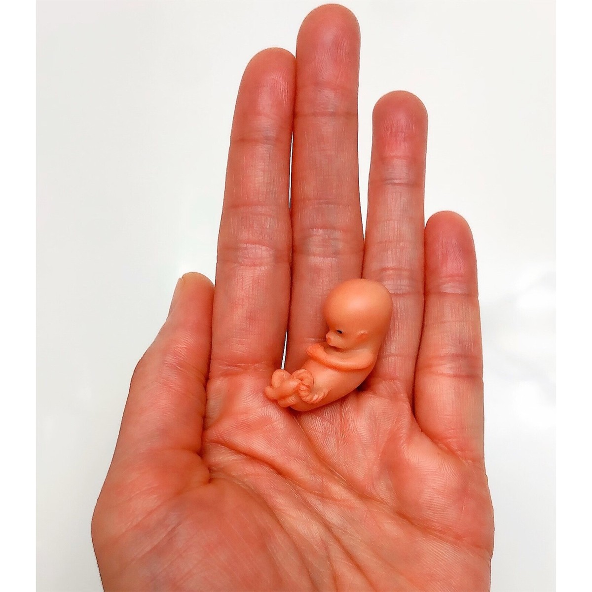 Real Fetus Pictures Week By Week