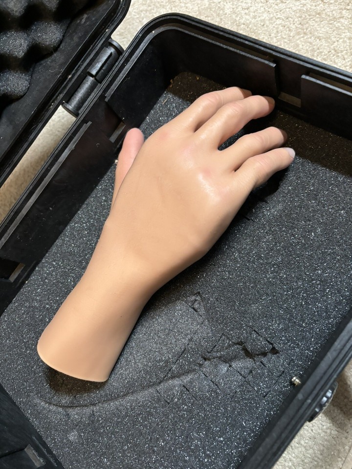 I-limb Ultra Touch Bionics Prosthetic Hand Electric | eBay