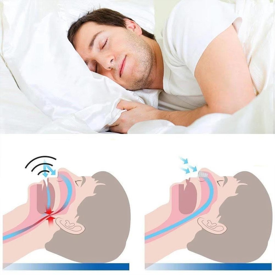 2026 New Arrival Adjustable Anti Snoring Device Mouthpiece Snore Stop ...