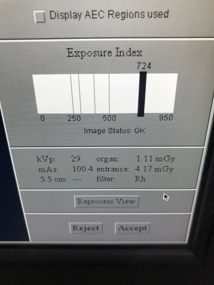 GAMMEX RMI 156 phantom 18-220 ACR QA mammography xray test tool Unfors ...