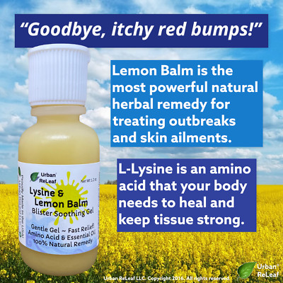 Urban ReLeaf Lysine Lemon Balm Blister Soothing Gel! Cold Sore Shingles ...