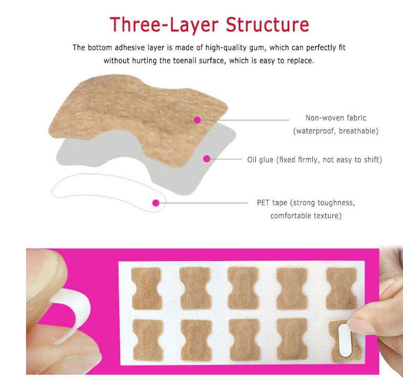 10 - 50pcs Ingrown Toe Foot Nail Correction Sticker Pedicure Toenail ...