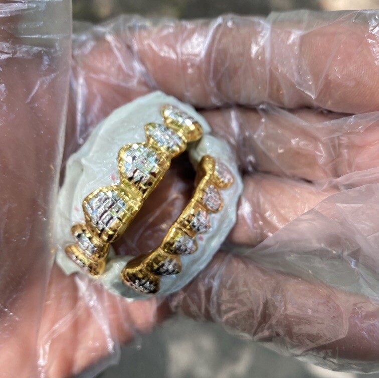Gold Teeth 2