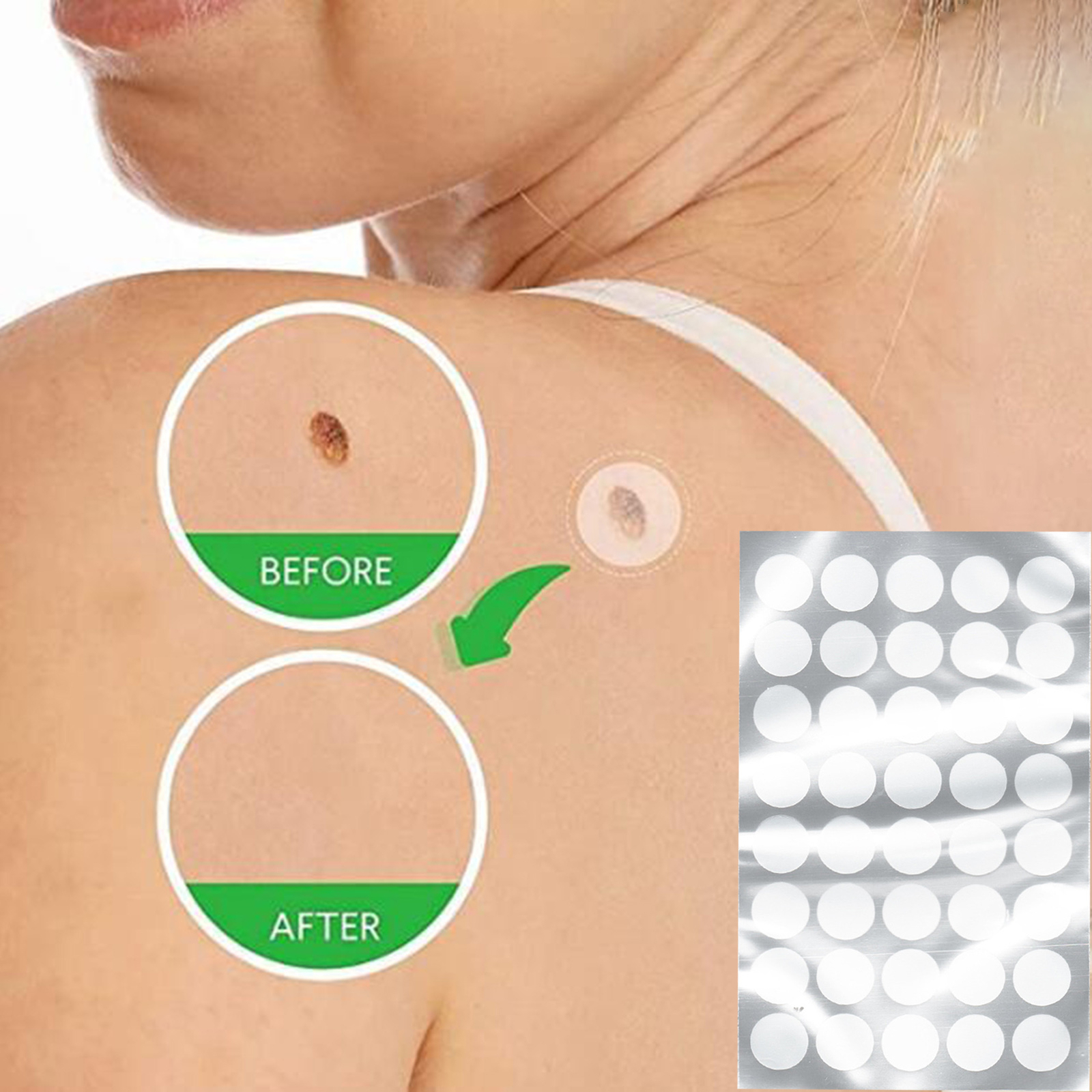 40Pcs Acne Cover Mole Invisible Sticker Warts Patch Skin Tags Remover Skin Care | eBay
