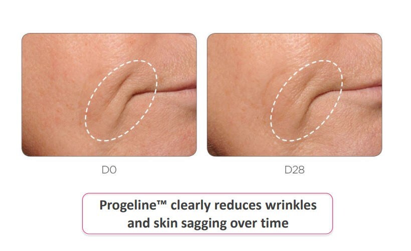 Progeline Firming Serum Booster With Pure Progeline For Anti Aging