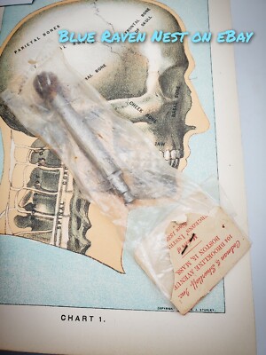 Surgical Tools - Skull Drill