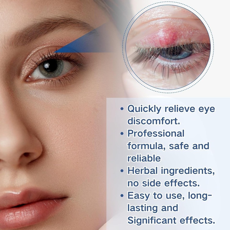 Stye Eye Treatment, Natural Stye Relief Serum for Styes, Chalazions and ...