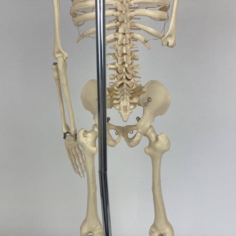 Educational Model Human Skeleton - 34” Long W Stand - Missing Right Arm ...