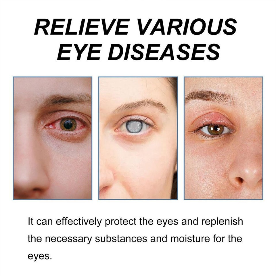 3 X Cataract Removal Eye Drop Improve Blurred Vision Restore Relieve ...