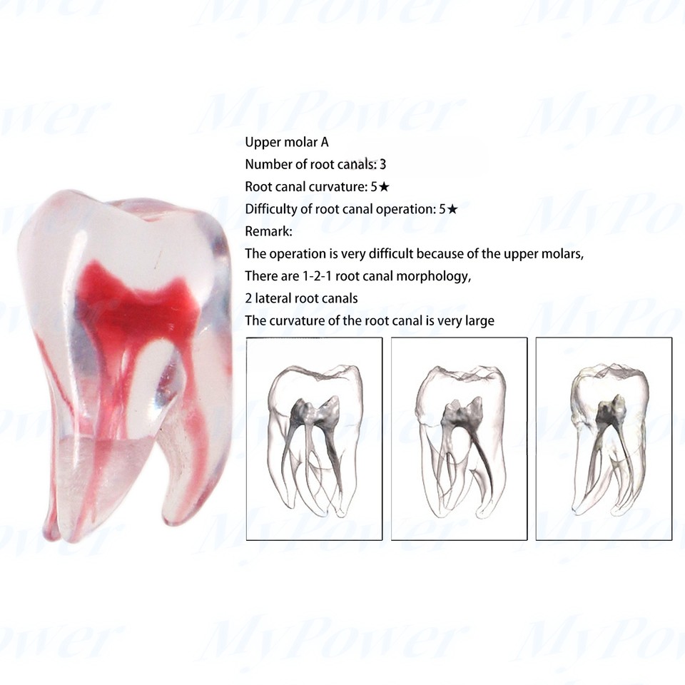 Dental Training 3D RCT Endo Tooth Model Practice Model Curved Root ...