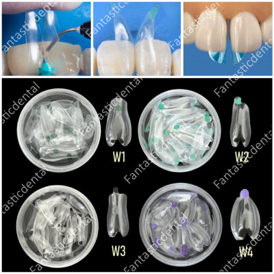 Dental Clear Matrix Anterior Transparent Matrices Restorative Fits for ...