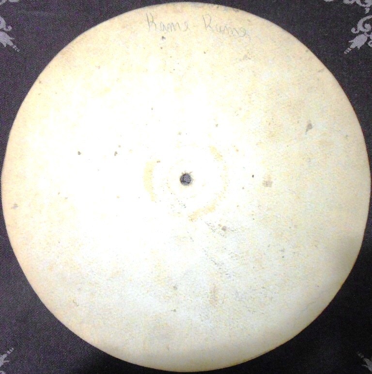 78RPM Soviet X-ray roentgen bones record, Peter Lestchenko, Strock ...