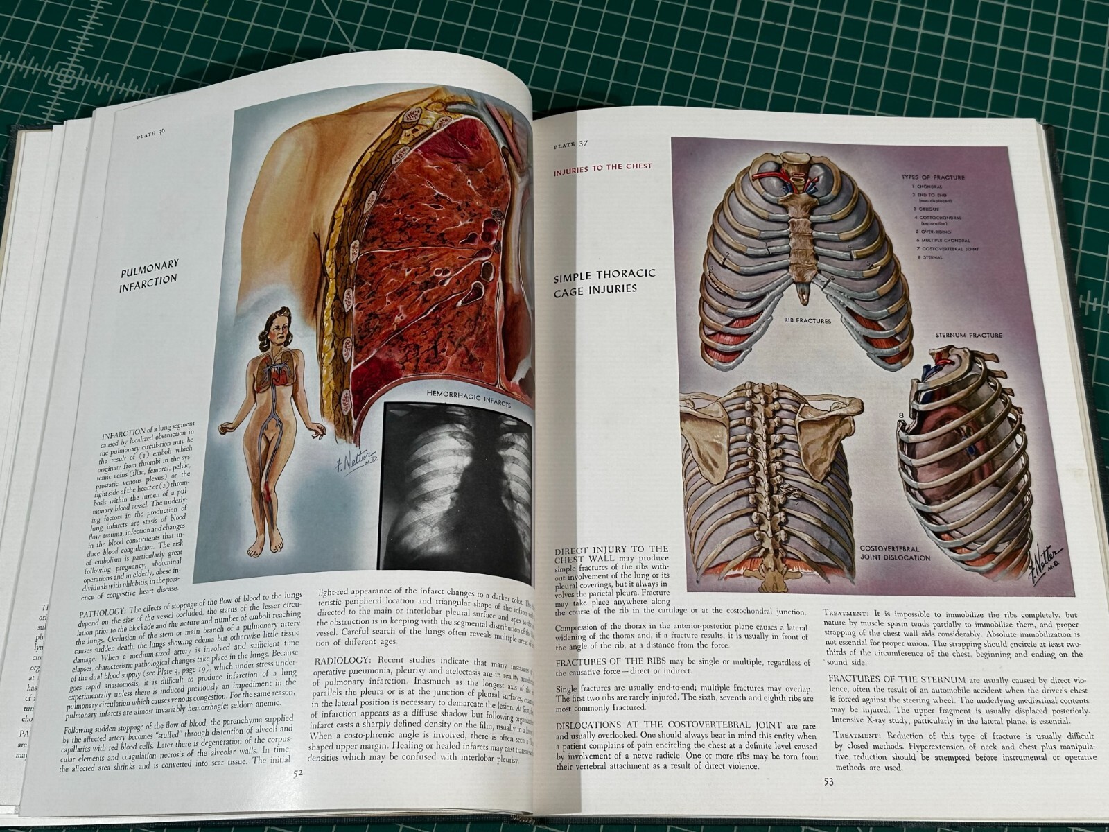The Ciba Collection of Medical Illustrations 1948 Frank H. Netter | eBay