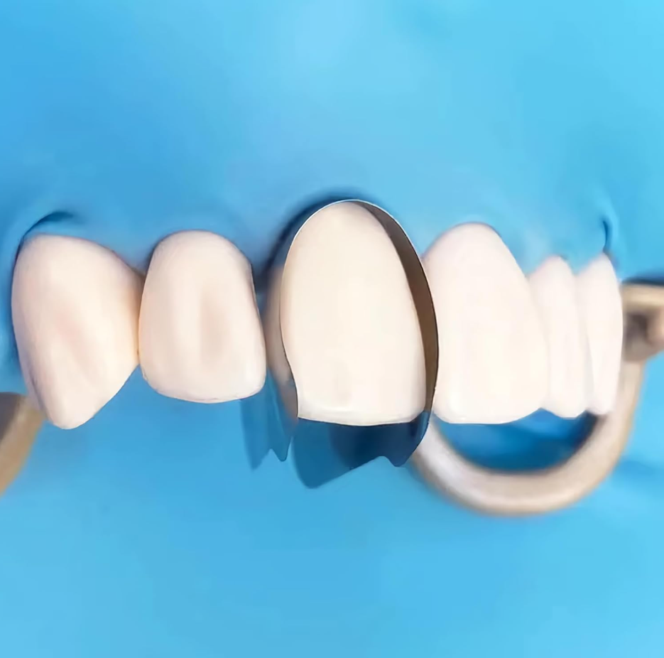 Dental Contoured Anterior Matrix Bands Restoration Metal Matrices ...