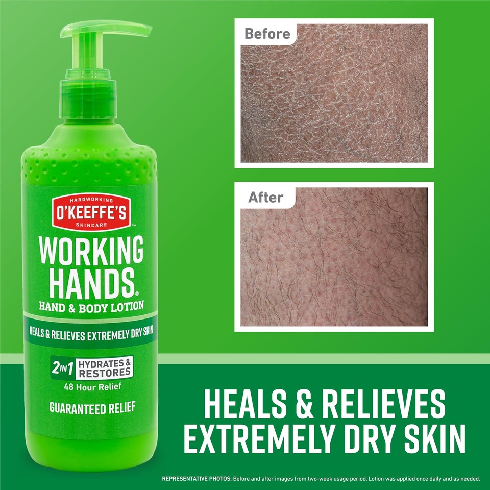 O Keeffe's Working Hands Hand and Body Lotion 12 Fl Oz Hydrates Dry ...