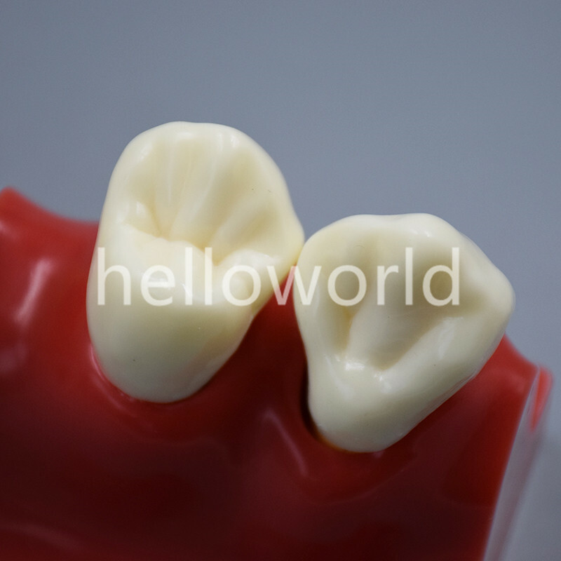 Dental Endodontic Study Teeth Model 4 Times Tooth Anatomy Anatomical ...