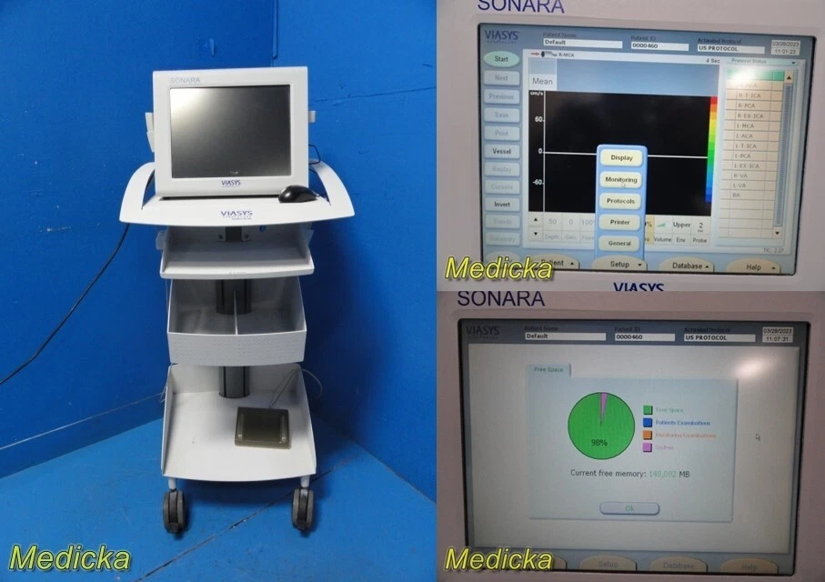 Transcranial Doppler Equipment