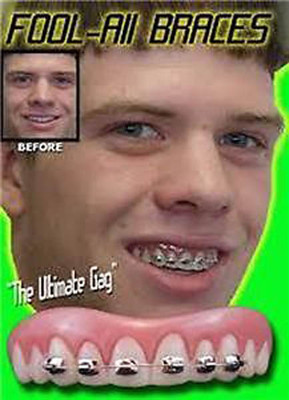 BILLY BOB TEETH WITH BRACES FAKE funny joke fun brace face gag costume ...