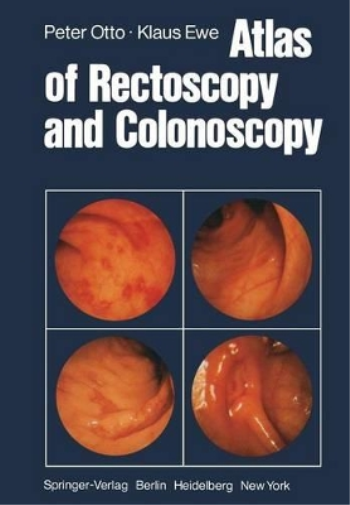 P. Otto K. Ewe Atlas of Rectoscopy and Coloscopy (Paperback) (UK IMPORT ...