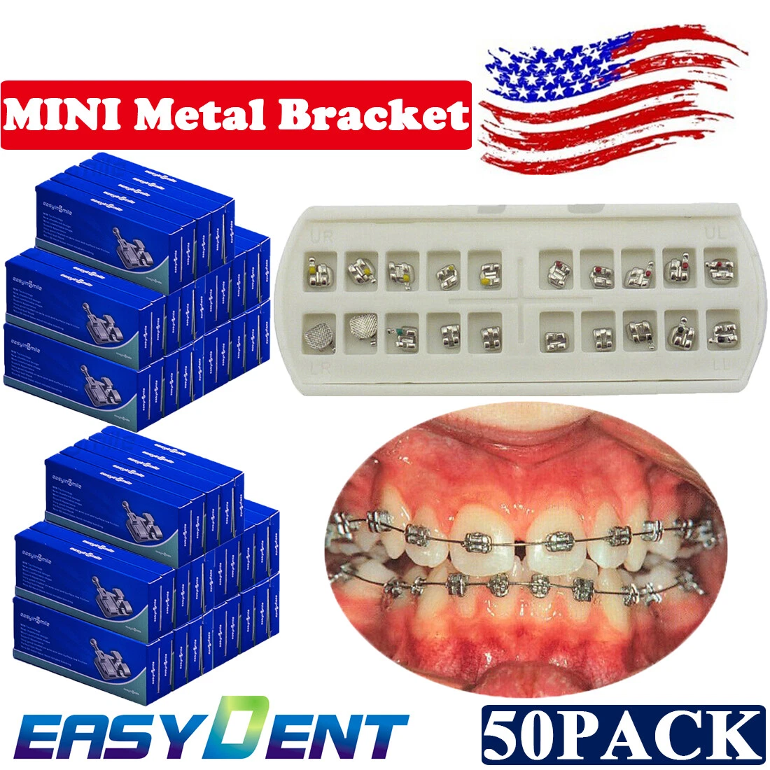 Metal Bracket Braces