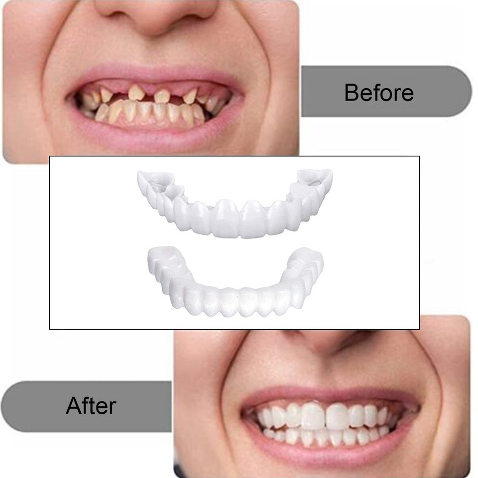Snap On Upper and Bottom Set False Teeth Dental Veneers Denture Tooth ...