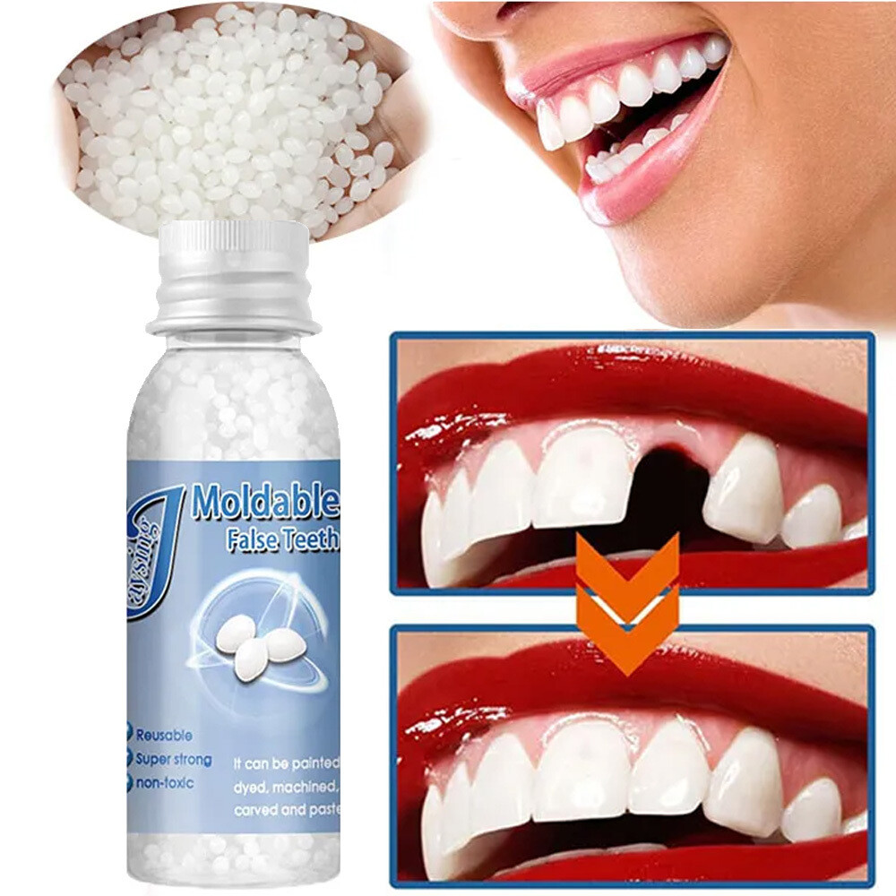 MISSING TOOTH FILLER TEMPORARY COSMETIC REPLACEMENT REPAIR DIY TEMP ...