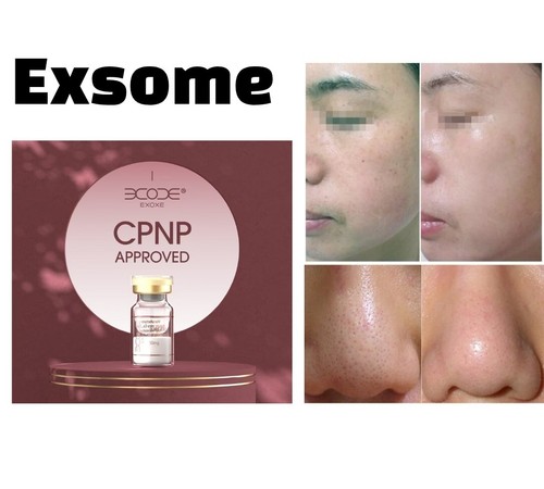 EXOXE Face & Hair Growth 2in1 Treatment Exsome K-Beauty "Good Effect ...