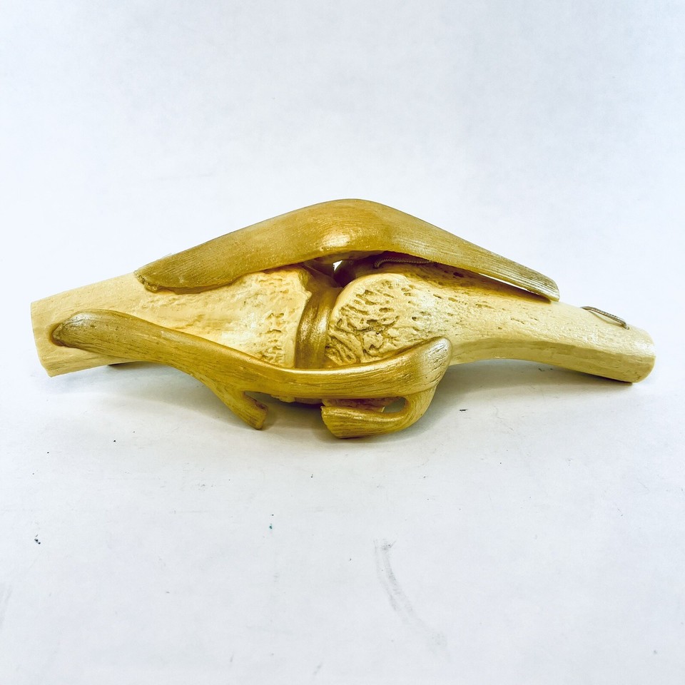 Human Knee Joint Model w/ Ligaments & Cartilage, Relafen Nabumetone ...