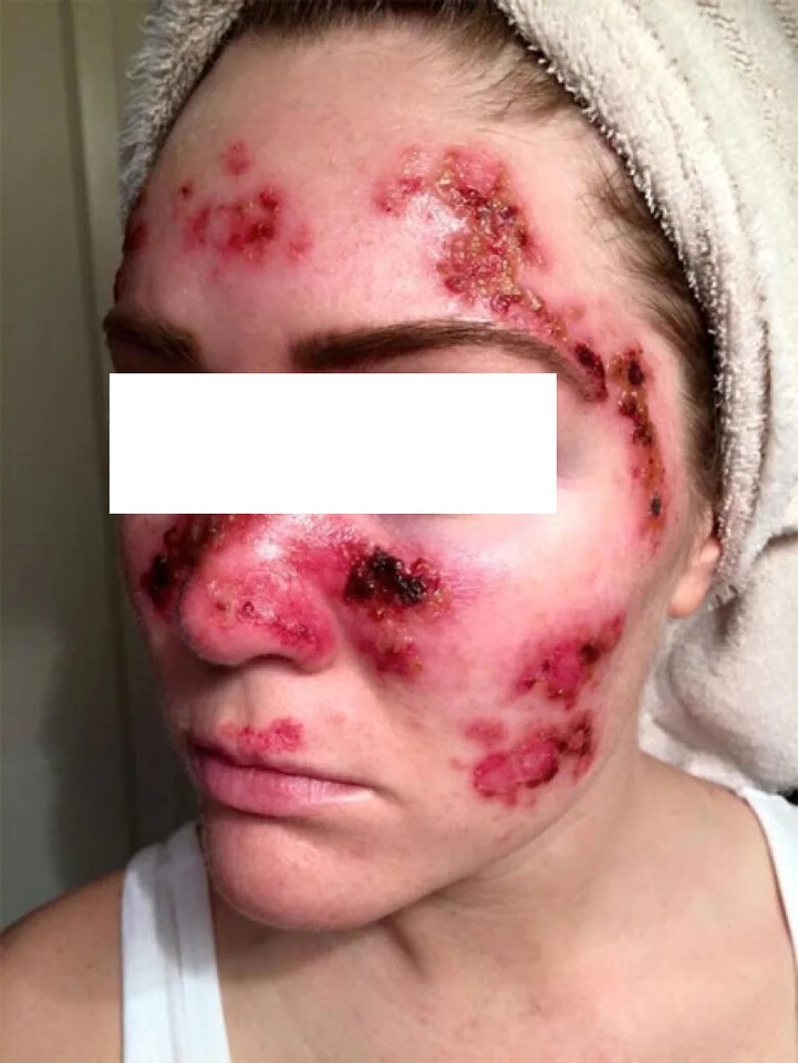 Curaderm BEC5 Plus+ Cream 30ml New Formula Full Spectrum ⭐⭐ ORIGINAL ⭐⭐ ...