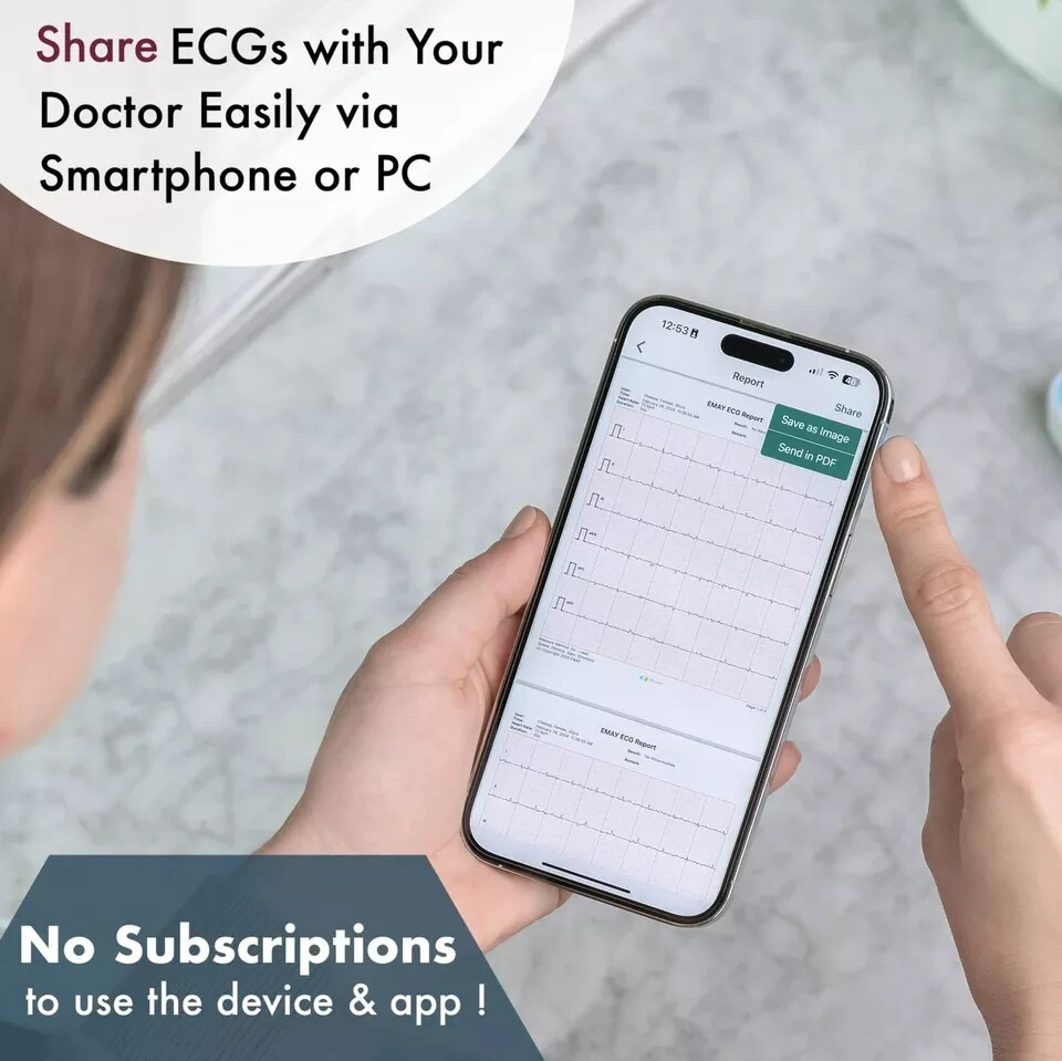 EMAY 6Leads Portable ECG Monitor Record ECG and Heart Rate in 6 ...