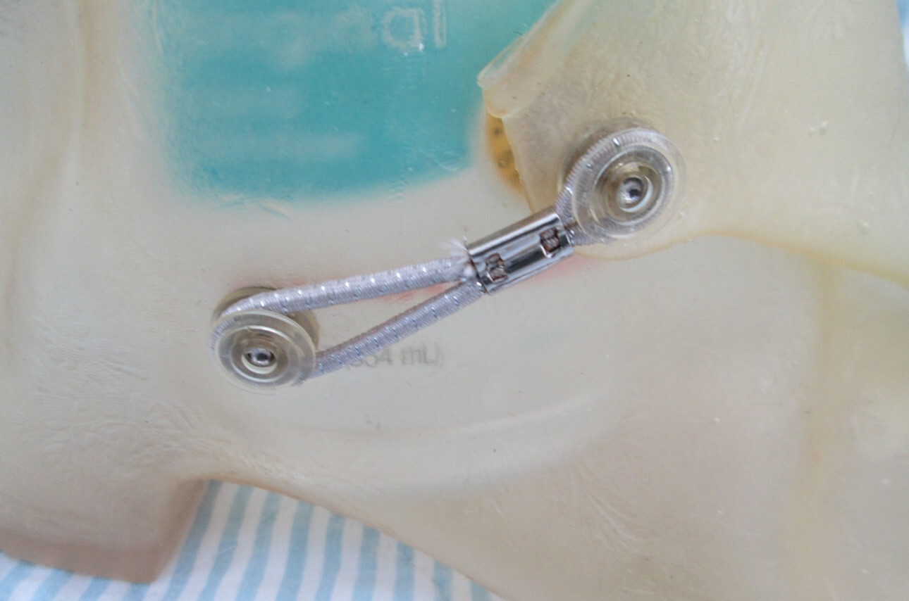 Vintage 1950s (?) Women's Heeled Overshoes/Galoshes (Rain Dears by ...