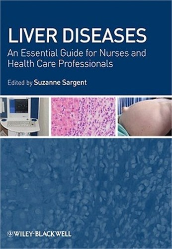 Liver Diseases: An Essential Guide for Nurses and Health Care ...