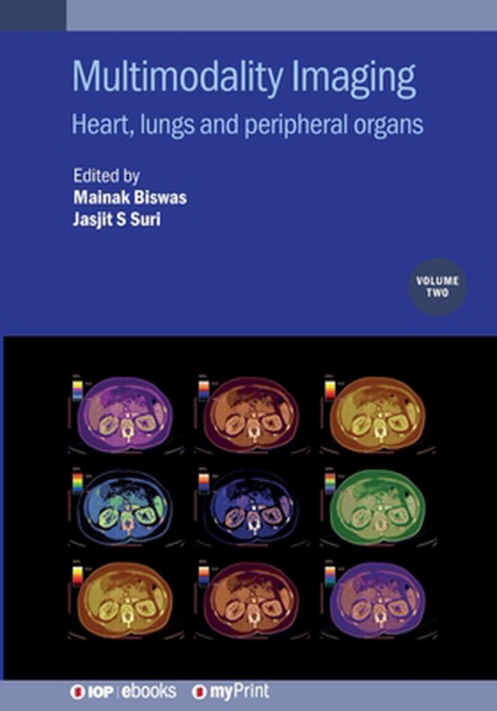 Multimodality Imaging, Volume 2: Heart, lungs and peripheral organs by ...