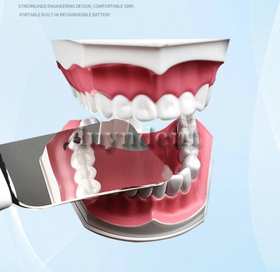 Dental Occlusal Mirror Fog Free LED Intra Oral Photo System Mirror Anti ...